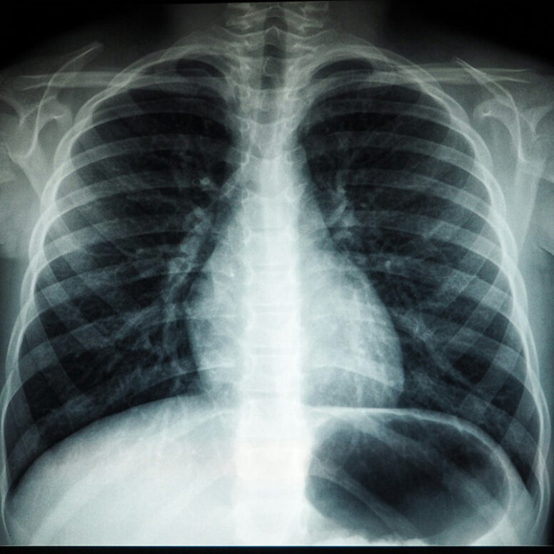 Private X-Ray Clinic In Aylesbury | Royal Buckinghamshire Hospital