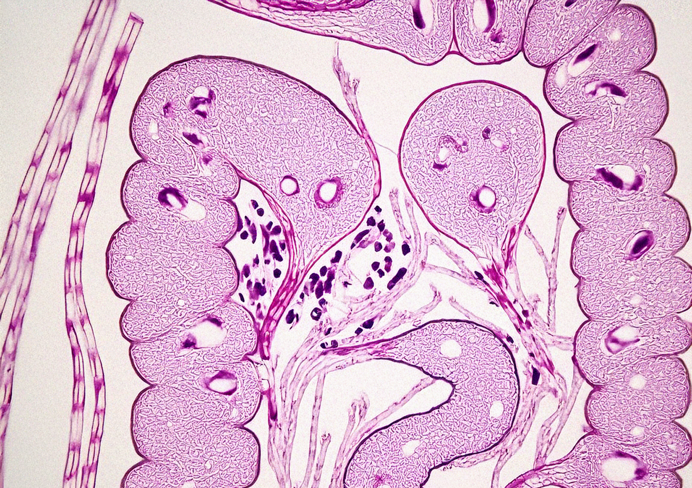 Blood In Stool | Conditions And Symptoms | The Royal Buckinghamshire ...
